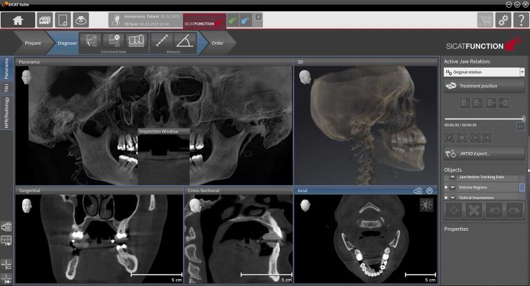 OPTIMOTION – SICAT