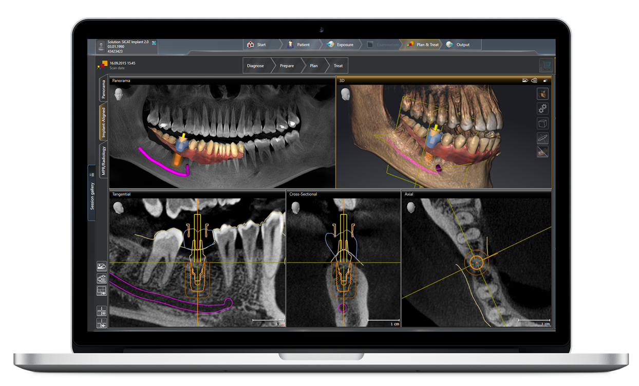 Implantology – SICAT