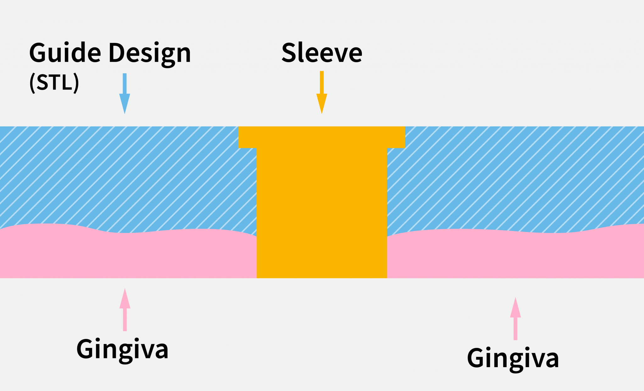 RAPID DIGITALGUIDE Support – SICAT