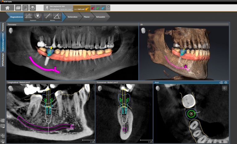 RAPID DIGITALGUIDE – SICAT