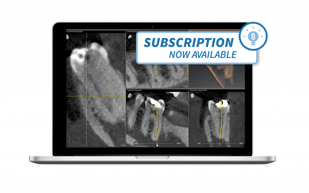 Endodontics – SICAT