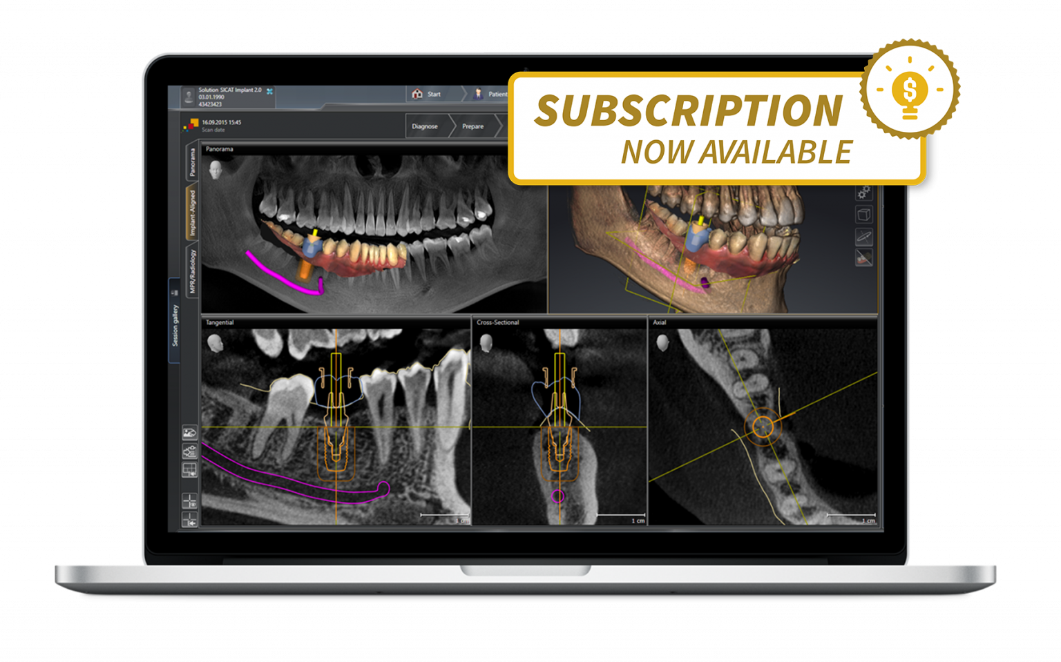 Implantology – SICAT