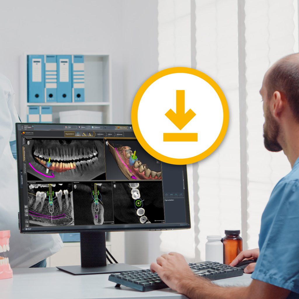 Now Available: Implant Database Update for SICAT Implant and Galileos ...