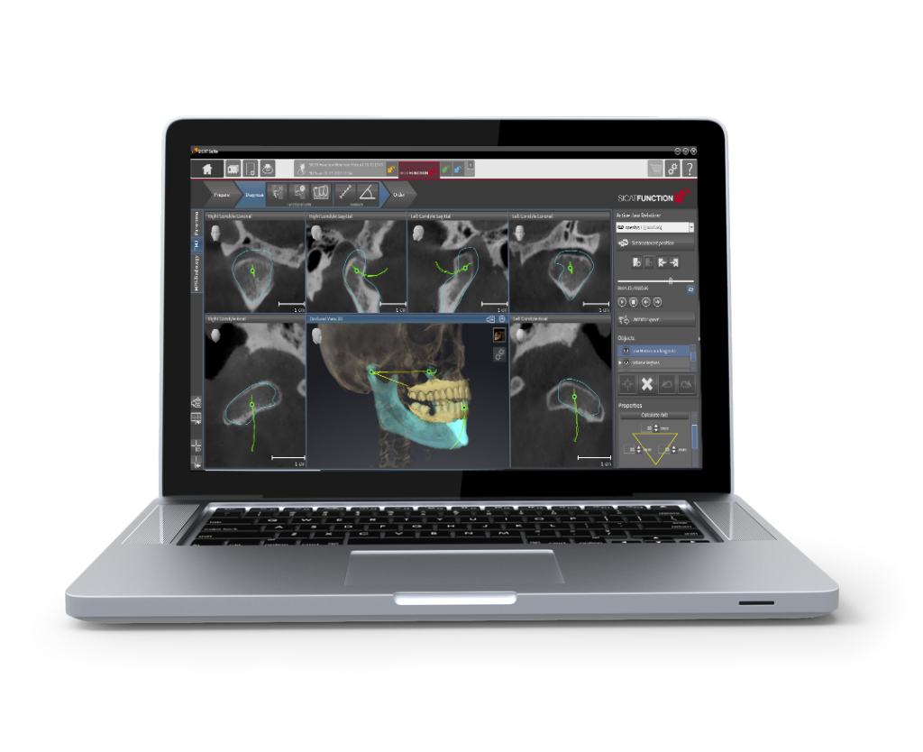 Functional Dentistry – SICAT